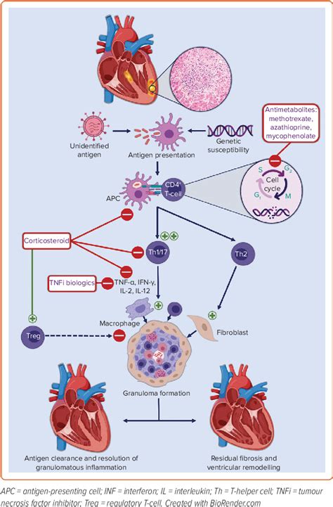 Figure 1 From Cardiac Sarcoidosis When And How To Treat Inflammation