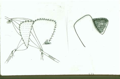 带蒂皮瓣的设计与移植，一文搞定！ 德医医学 助力医学教育发展！
