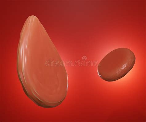 Dacrocyte Stock Illustrations 3 Dacrocyte Stock Illustrations