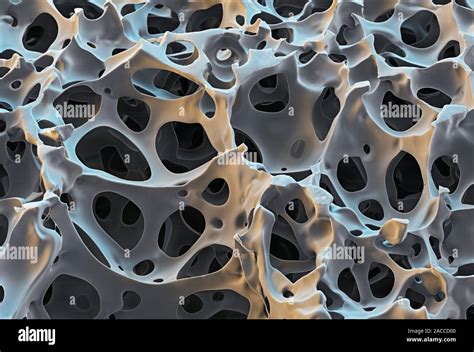 Superabsorbent Polymer Coloured Scanning Electron Micrograph Sem