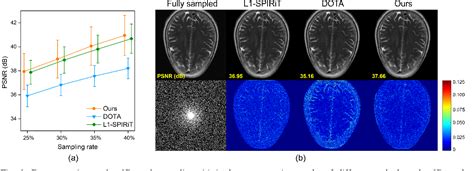 Figure 3 From A Plug And Play Synthetic Data Deep Learning For Undersampled Magnetic Resonance
