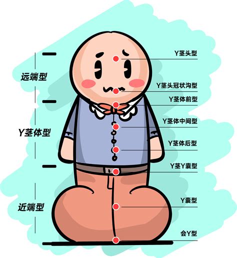 辨别男孩丁丁是否 尿道下裂”畸形，看这3个异常表现 知乎