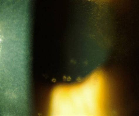 Distinguishing Dendrites Eyeworld