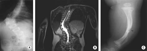 Congenital Skeletal Anomalies Clinical Tree