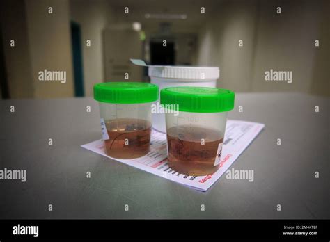 Tissue Samples Are Placed In Formalin For Subsequent Examination By A