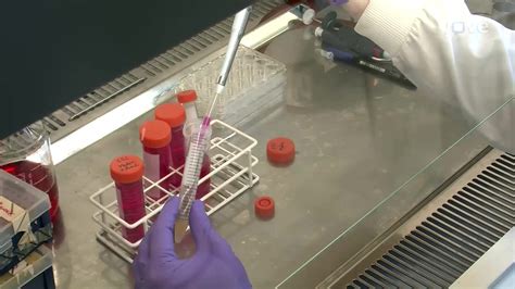 Video Selectively Removing Microglia From A Rat Cerebellar Granule Neuron Culture Experiment