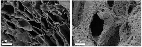 Osteogenic Cells And Microenvironment Of Early Bone Development And