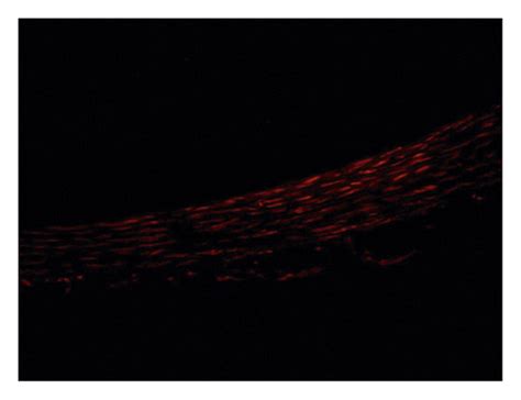 Detection Of Superoxide Anions O2− Generation In Aorta Download