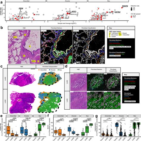 Multiplexed Ihc Mxihc And Digital Cytometry Show That Fibroblast