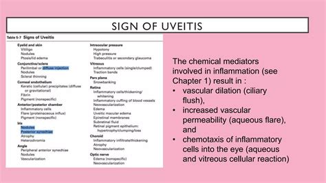 Slide Uveitis Anterior To Posterior Pptx
