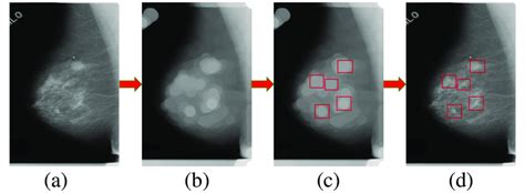 Process Of Candidate Region Generation For Breast Mass In A