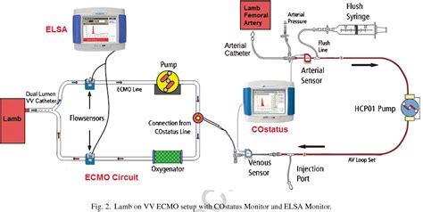 Ecmo Circuit