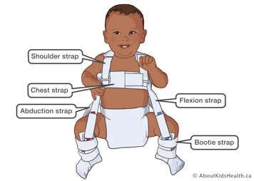 Pavlik Harness