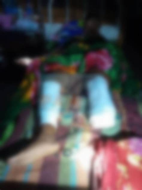 မိုင်းထိလို့ ဆေးရုံတက်ကုနေရတဲ့ Pdf ၁ ဦး စစ်ကောင်စီတပ်ရဲ့ဖမ်းဆီးခြင်းခံရ