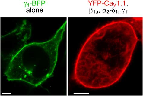 Stac3 Has A Direct Role In Skeletal Muscle Type Excitation Contraction Coupling That Is