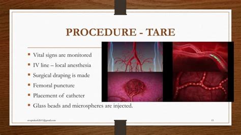 Transarterial Radioembolization Tare Pptx