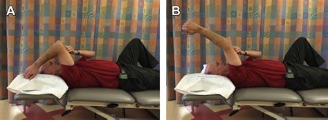 Simple Elbow Dislocation Hand Clinics
