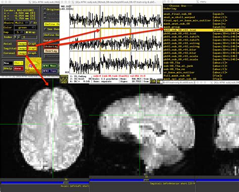 Chapter 7 Checking Preprocessing — Andys Brain Book 10 Documentation