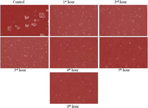 Anticancer Activity Of Ce Doped Tio2 Download Scientific Diagram