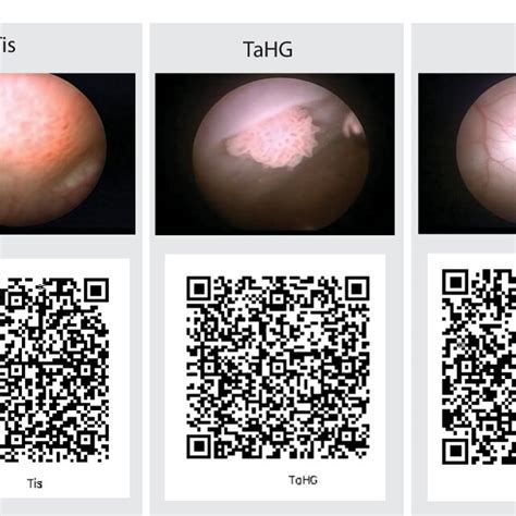 Representative Examples Of A Lesions Representing The Major Categories Download Scientific