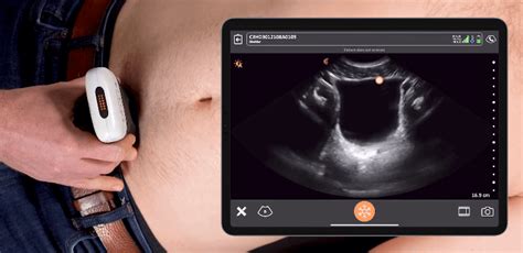 10 Best Bladder Scanners 2024 Complete Price List With Cost Bladgo®