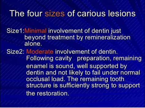 4 Mounts Classification Easy Operative Dentistry