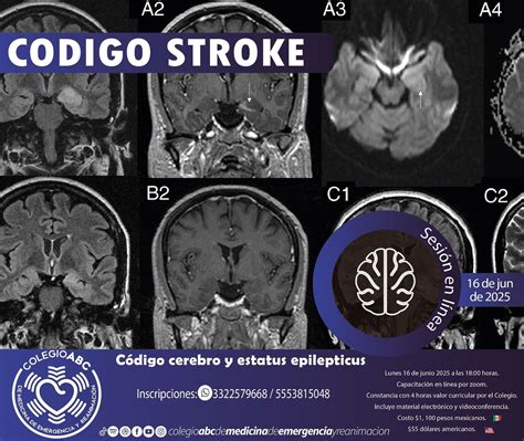Colegio Es Hoy 🧠código Cerebro Código Stroke Y Estatus