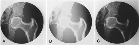 Exposure Technique Factors Radiology Key