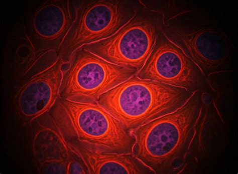 The Quiet Danger Of Chronic Inflammation Neuluna