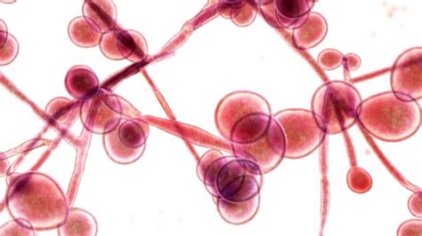 Montana Doctor Eyeing Spread Of Potentially Deadly Candida Auris Fungus