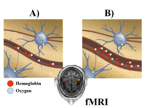 Monitor Brain Activity Using Functional Magnetic Resonance Imaging