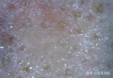 毛戈平化妆学校去黑头是真有一套，学会后解决黑头闭口，自己在家也能搞 知乎