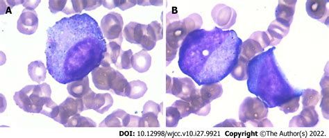 Neutrophilic Myelocyte