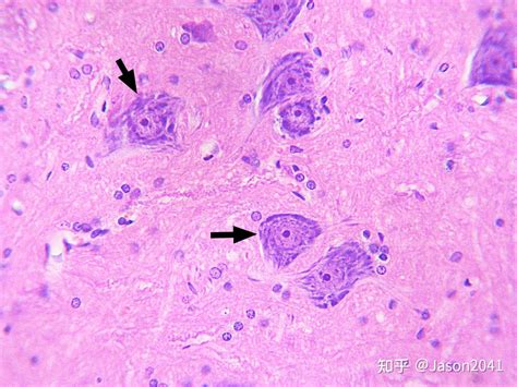 神经组织i 光镜下显示正常神经元和胶质细胞的方法 知乎