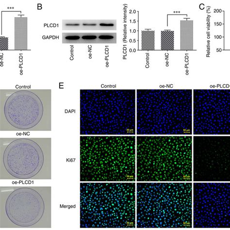 Overexpression Of Plcd1 Inhibits Lung Adenocarcinoma Cell Download