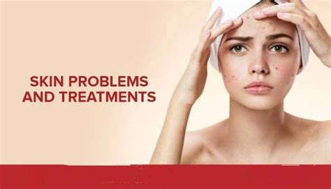 Skin Problems And Treatments