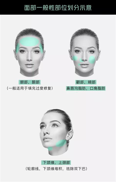 射频溶脂紧致，黄金微雕是什么？