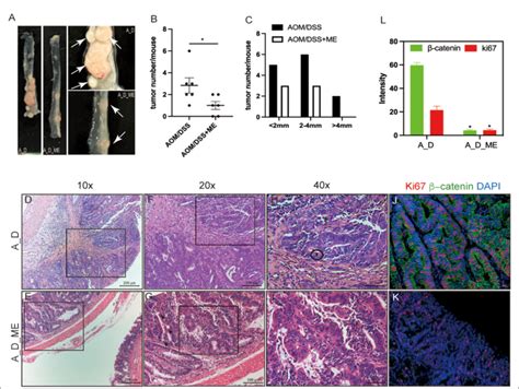 Figure Decreasing Severity Of Inflammation And Carcinogenesis In