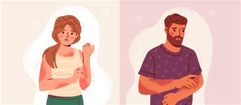 Cellulitis Vs Erysipelas Bacterial Causes Risk Factors