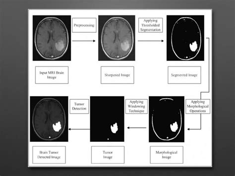 Brain Tumor Detection Pptx