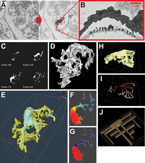 Image Segmentation Volume Reconstruction And Quantitative Analysis Of
