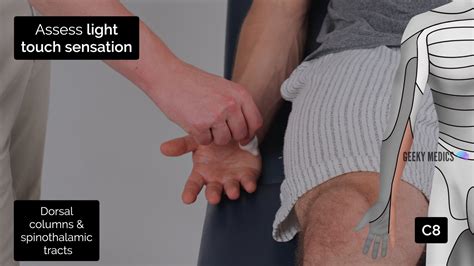 Upper Limb Neurological Examination Osce Guide Geeky Medics