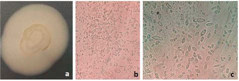 Aureobasidium Pullulans Mold