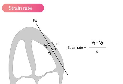 Strain Strain Rate And Speckle Tracking Myocardial Deformation The