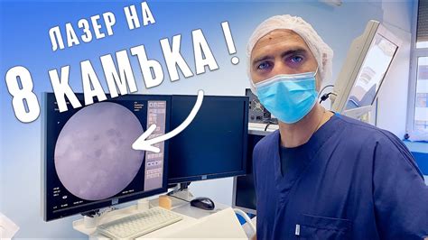 Лазерно разбиване на 8 камъка в бъбрека Видео Urology Bg