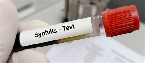 Syphilis Archives Public Health Insider