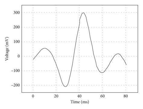 A Biphasic Waveform Applied On The Most Reported Tes B A New Download Scientific Diagram