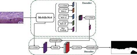 Deeplabv3 Model With Mobilenet As A Backbone Network Download Scientific Diagram