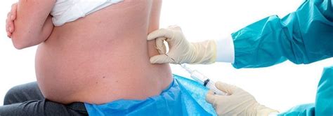 The Facts Behind An Epidural HealthyPregnancy Com