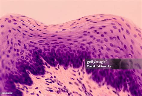 Stratified Squamous Epithelium Non Keratinized Esophagus Section Of